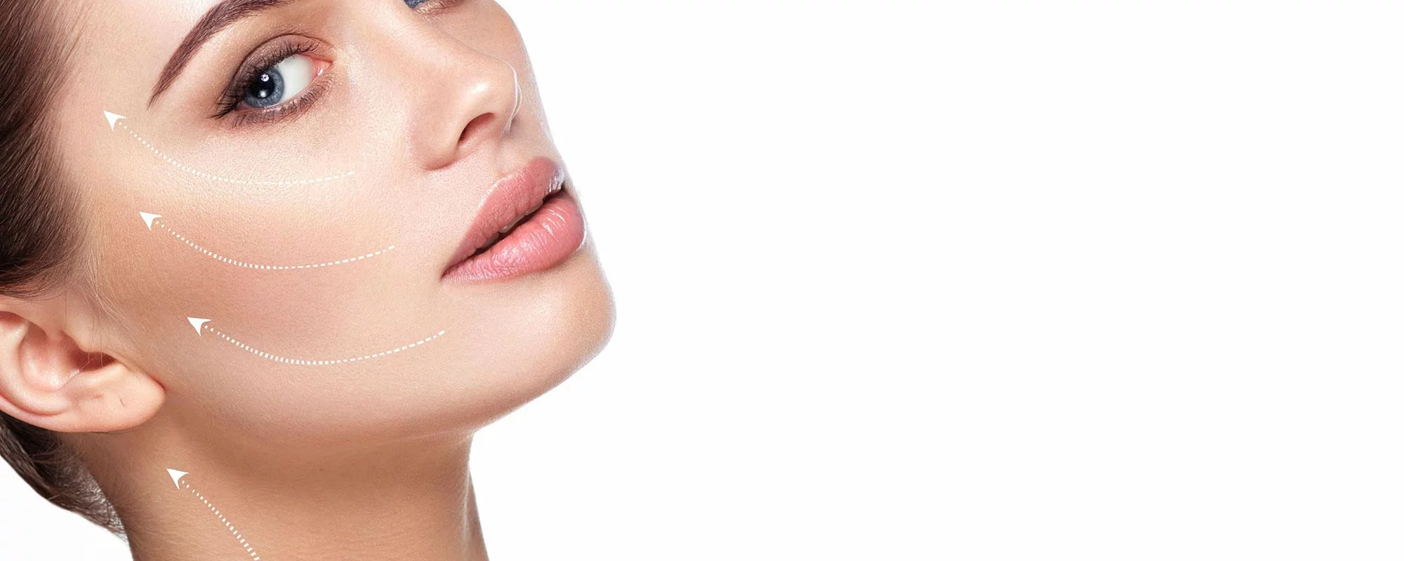 Meso Lift - Leaders Aesthetics