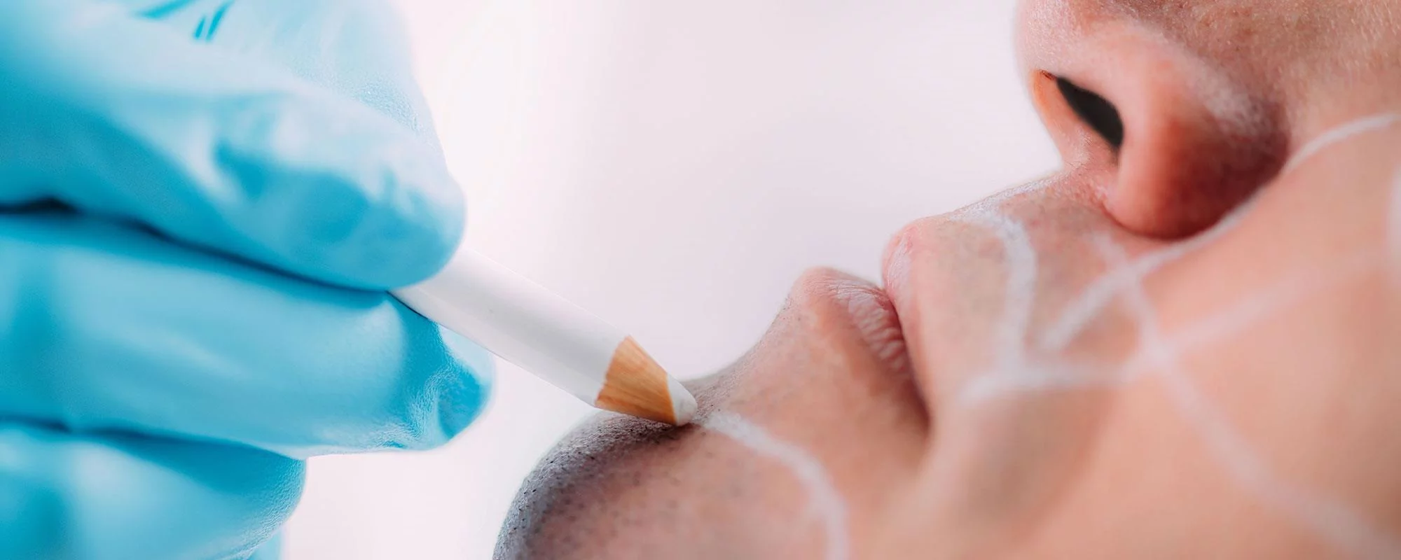 Dermal Fillers Men - Leaders Aesthetics